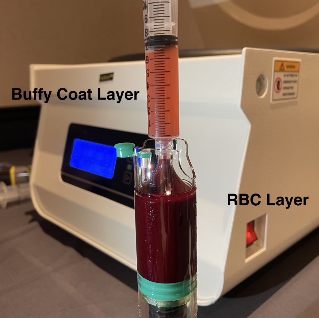 PRP Therapy Phoenix & Scottsdale AZ