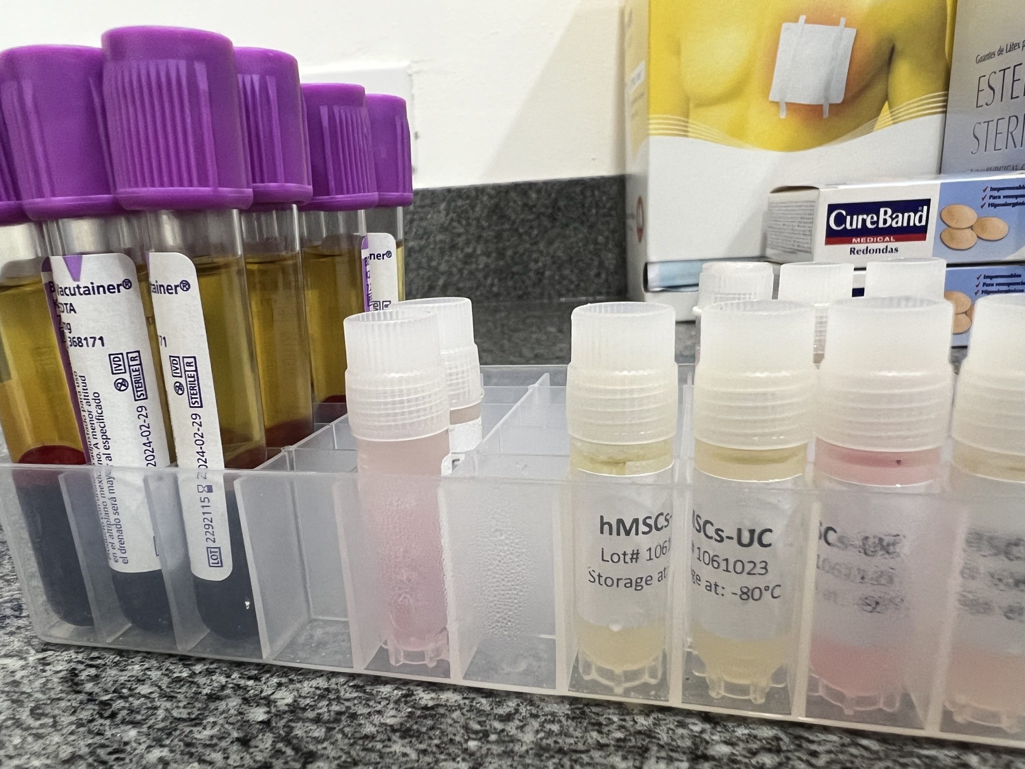 Comparing Fresh versus Frozen Stem Cells - R3 Stem Cell