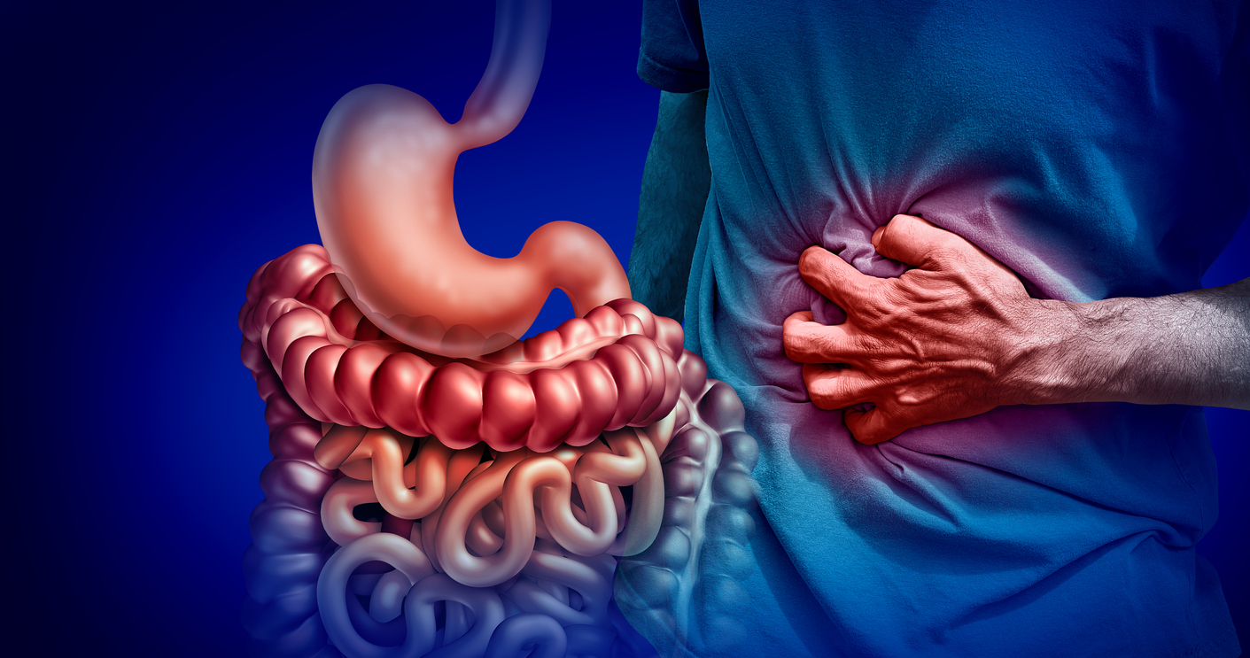 Latest On Stem Cells For Ulcerative Colitis R3 Stem Cell 8633
